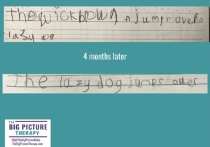 Asymmetrical Tonic Neck Reflex (ATNR): academic skills and eye-hand ...