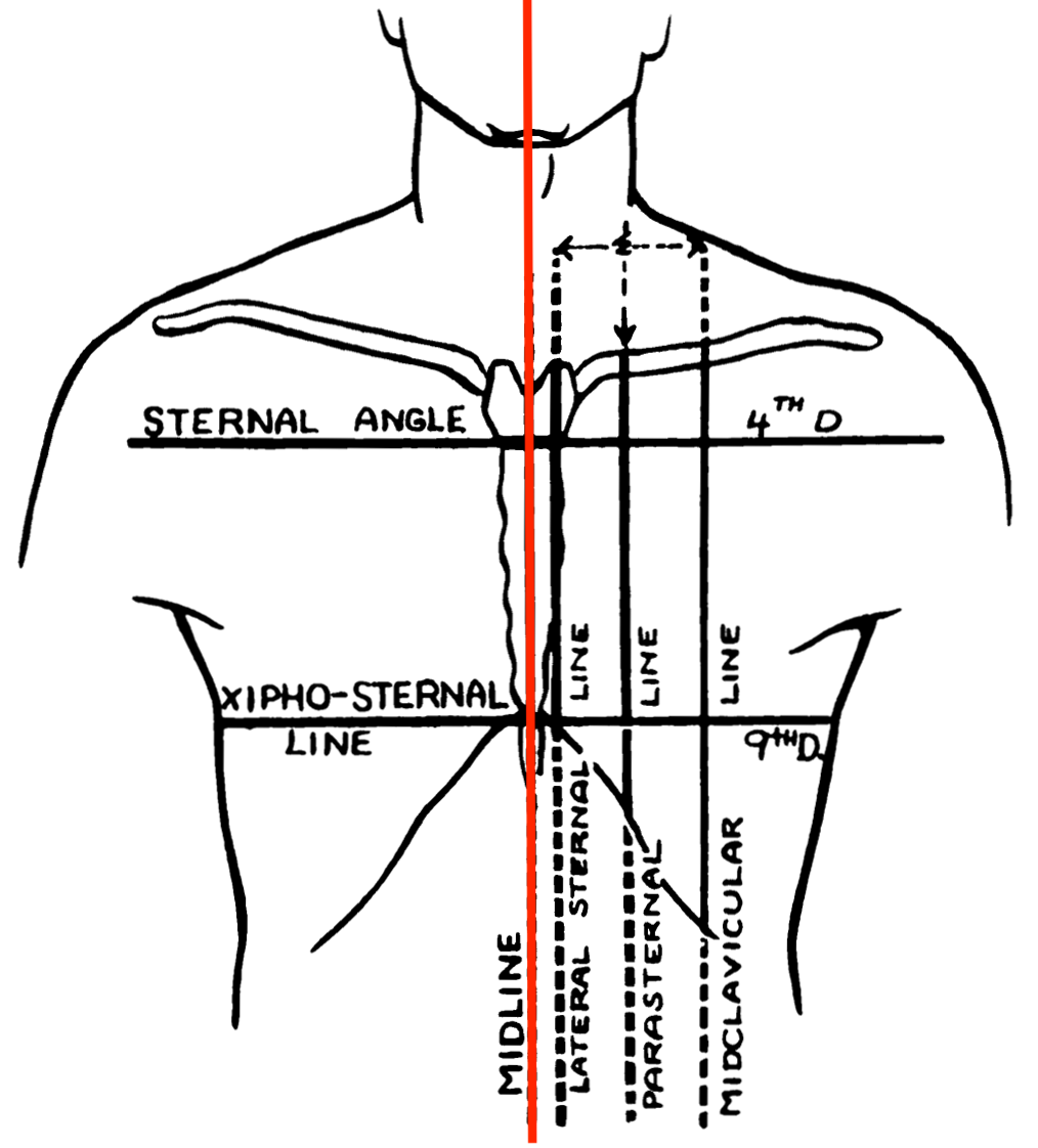 Asymmetrical Tonic Neck Reflex (ATNR): academic skills and eye-hand ...