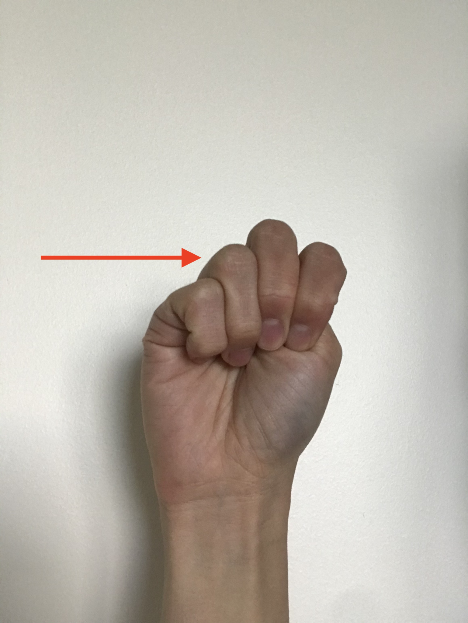 The Hand Model of the Brain Blog #12 - The Big Picture Therapy