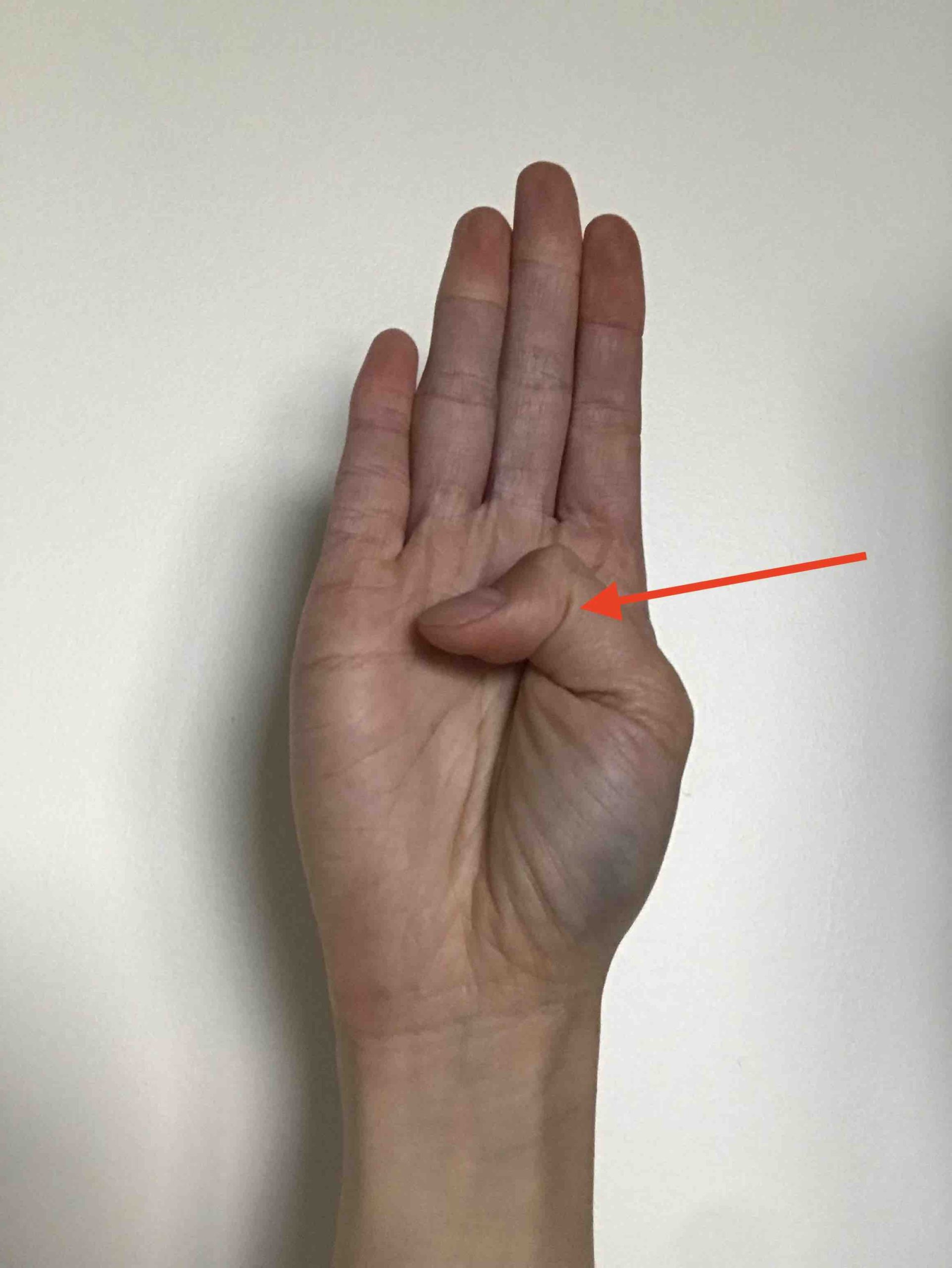 The Hand Model of the Brain Blog #12 - The Big Picture Therapy